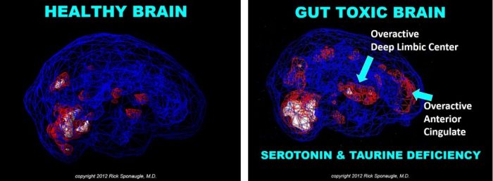 Gut Toxicity: Impact Of Antibiotics & Environmental Toxins