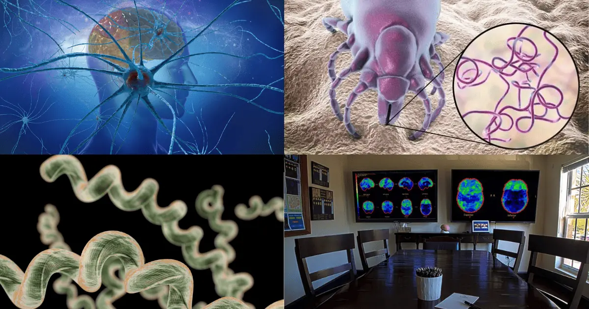 Neuroborreliosis: Neurological Manifestation Of Lyme Disease